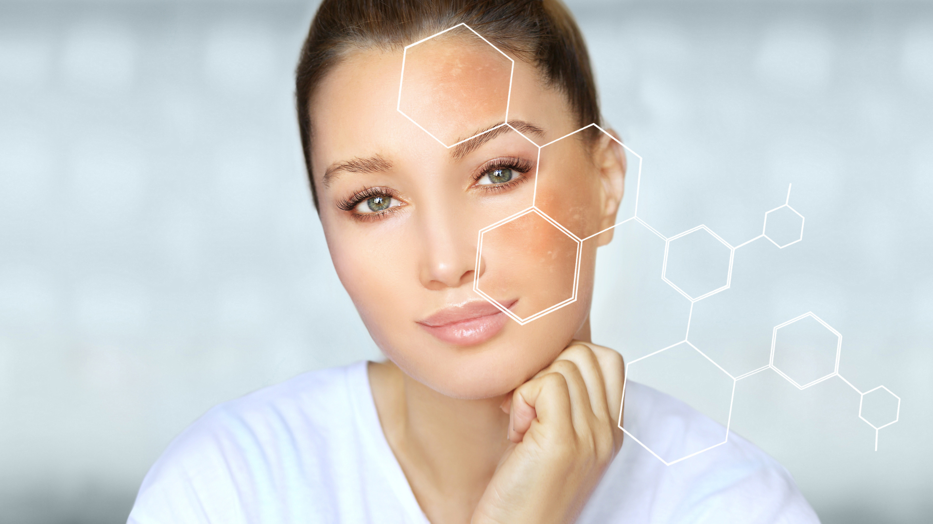 Prevention, Not Cure: Sun Damage to the Skin Is Irreversible